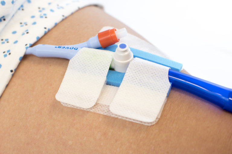 Product Category: Urological | M.C. Johnson