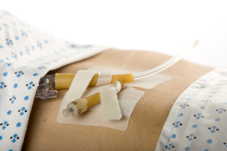 Product Category: Urological | M.C. Johnson