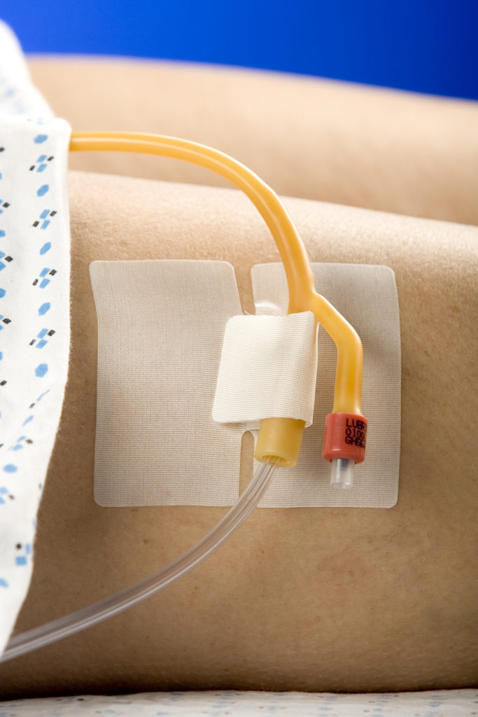 The Original CATH•SECURE® | M.C. Johnson