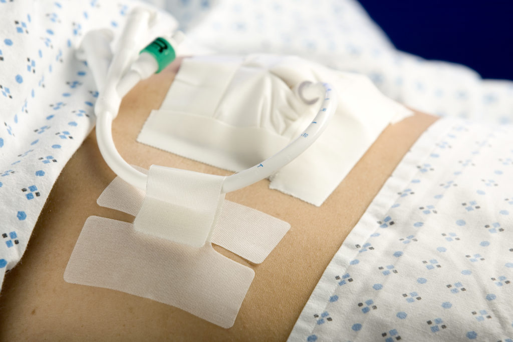 CATH•SECURE® | M.C. Johnson