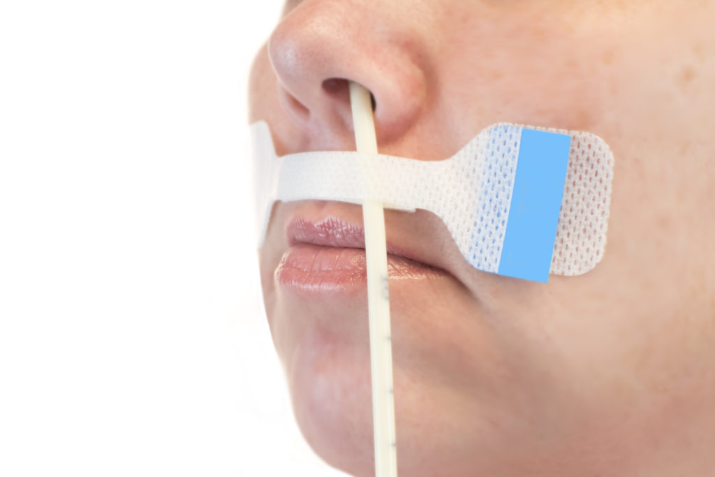 NG•SECURE® | M.C. Johnson